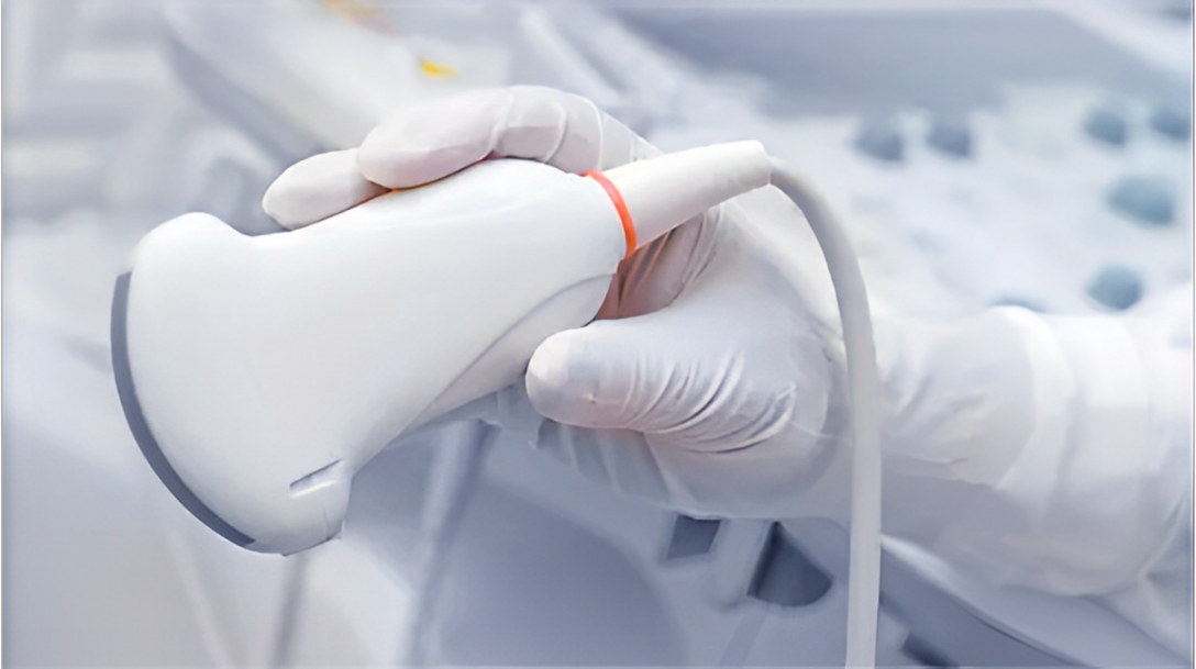 Ultrasonido Prostático: Diagnóstico y Beneficios