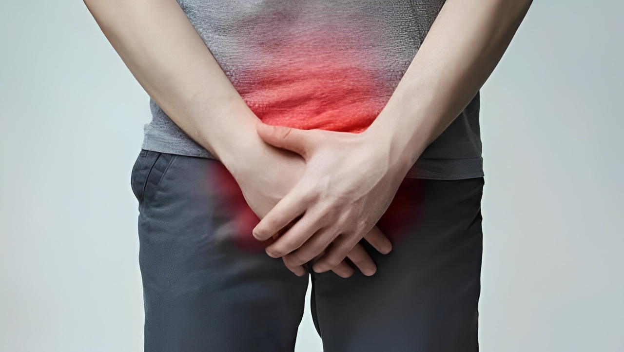 Priapismo: Causas y Tratamiento para Erección Prolongada