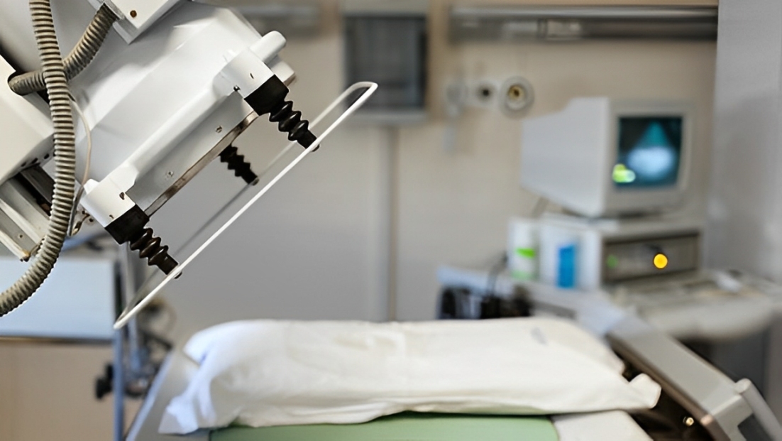 Litotricia: Tratamiento efectivo para cálculos renales sin cirugía